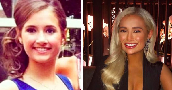 Love Island: The Islanders with the most shocking teeth transformations