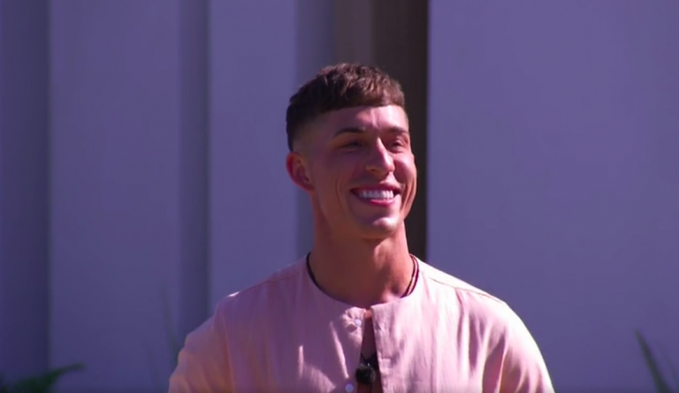 Winter Love Island: This is what Connor's teeth looked like pre-veneers
