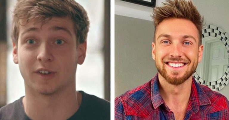 Made in Chelsea teeth transformations: Who has changed over the years