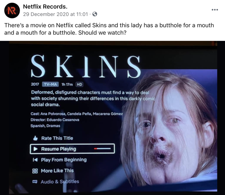 People are freaking out over Netflix film about deformities called Skins